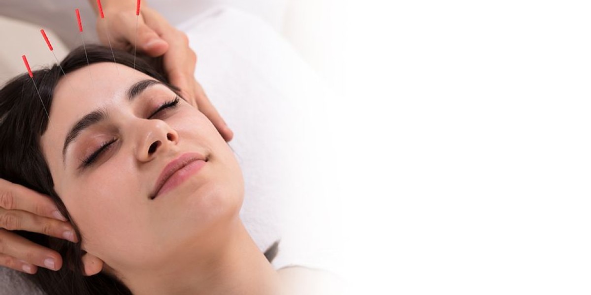 Motor Points in Facial Acupuncture | Acupuncture Today
