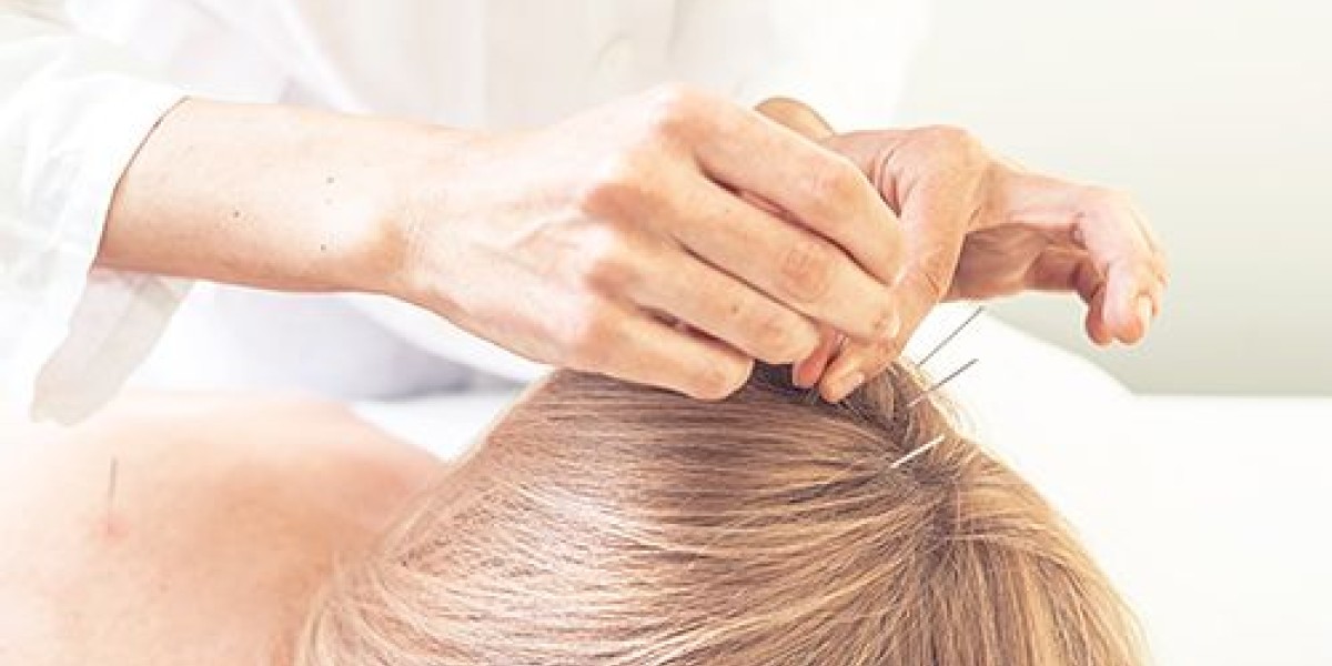 Scalp Acupuncture (Pt. 2) | Acupuncture Today