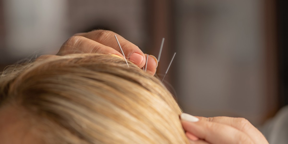 Objective Indicators of Brain MRI Changes After Acupuncture Treatment ...