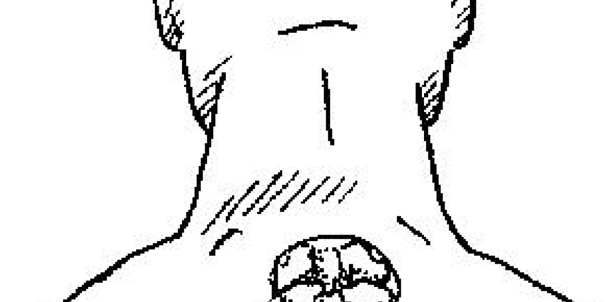 GV14 (Dazhui): Big Vertebrae-Central Reunion Point | Acupuncture Today