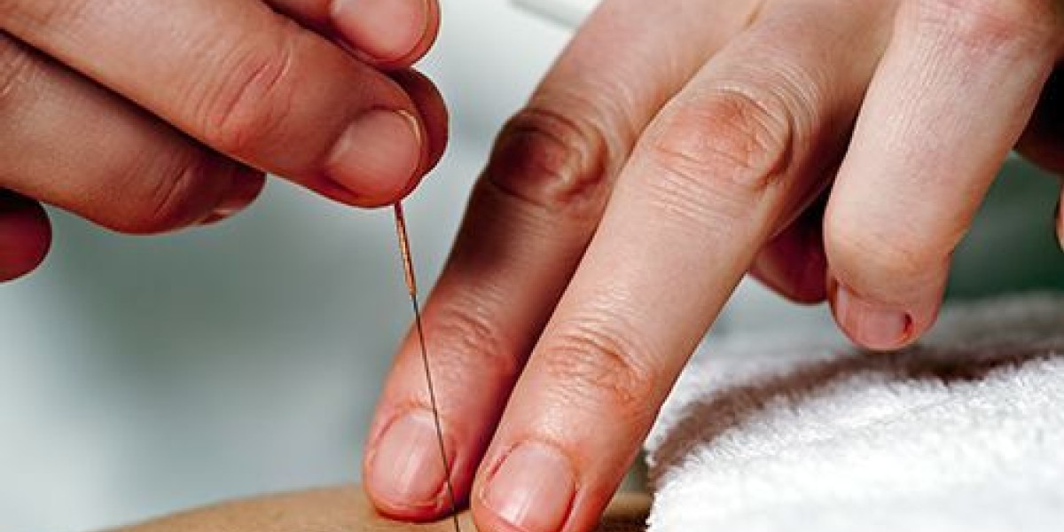 Mechanism: Experimental Approaches to Understanding Acupuncture, Part 1 ...