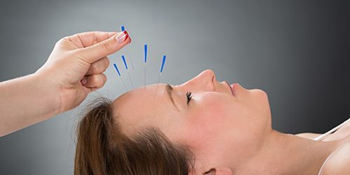 The Importance of Shen in Cosmetic Acupuncture | Acupuncture Today
