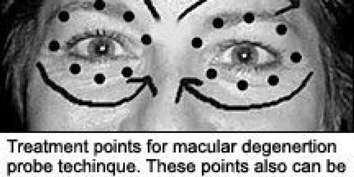 Is Microcurrent Therapy Effective for Treatment of Macular Degeneration ...